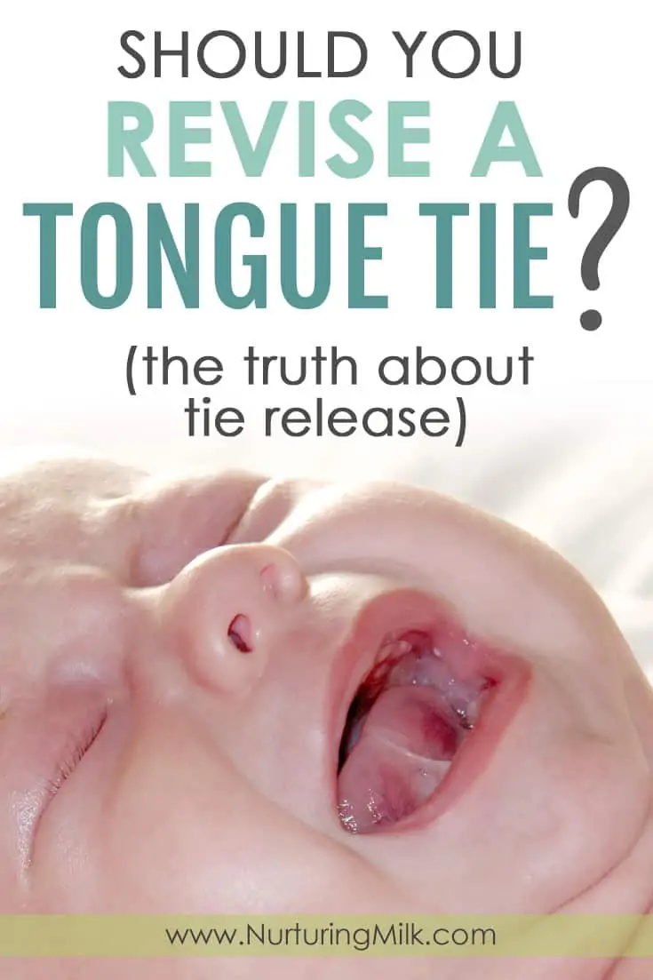 Everything You Need To Know About Tongue Ties Nurturing Milk